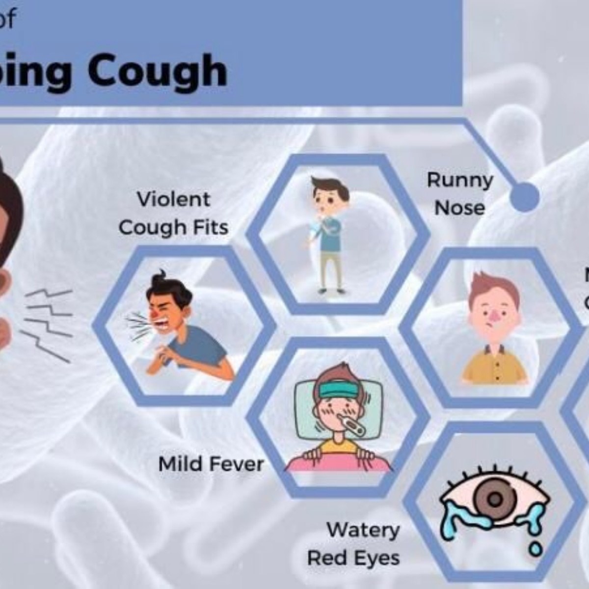 Whooping Cough Symptoms And Treatment